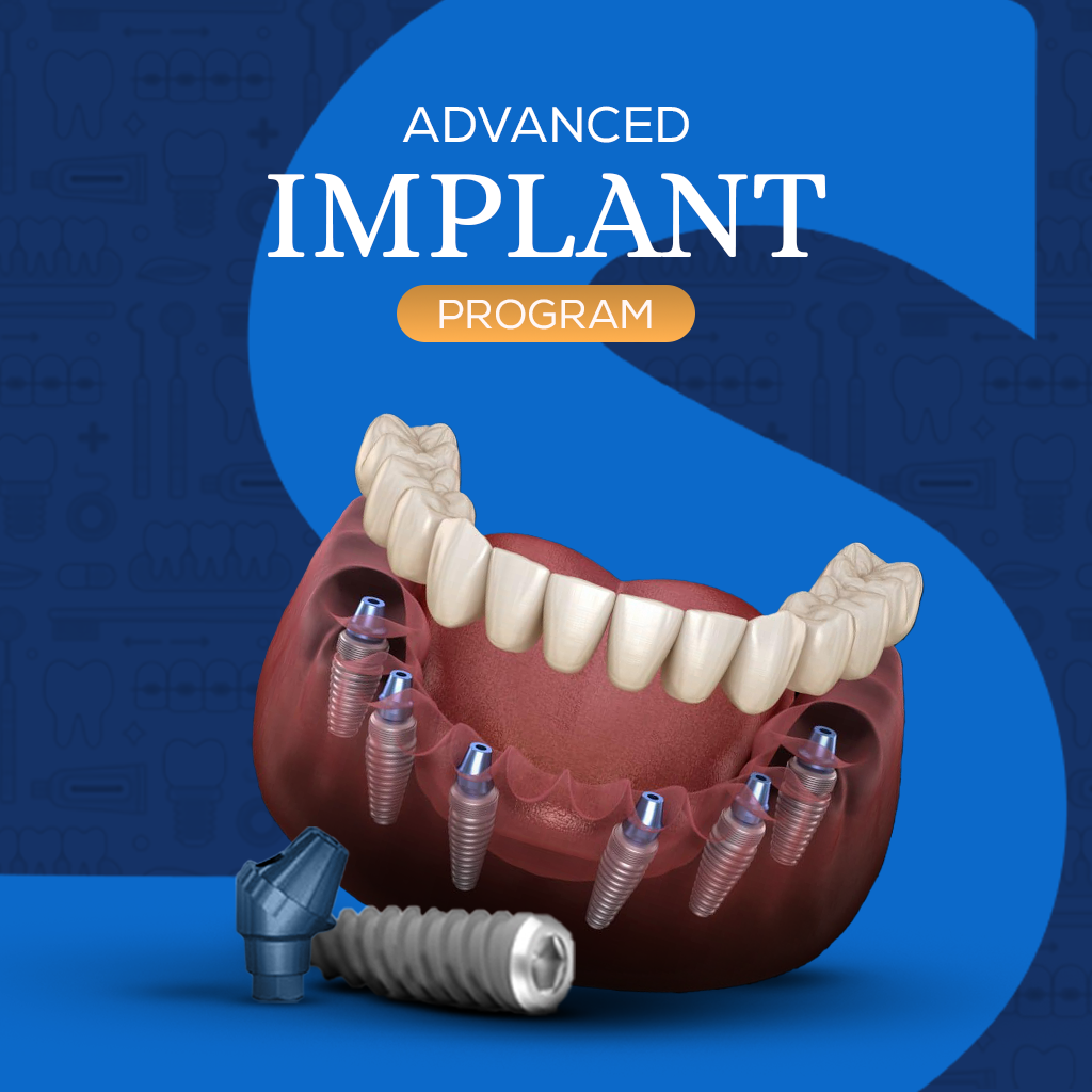 Advanced Implant Program – SPC For Continuing Education