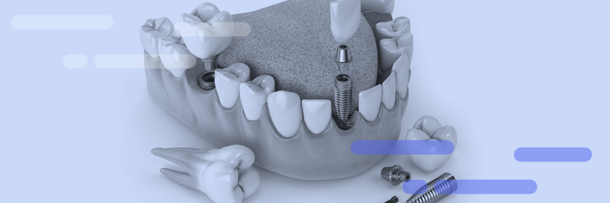 Comprehensive Implant Residency – SPC For Continuing Education